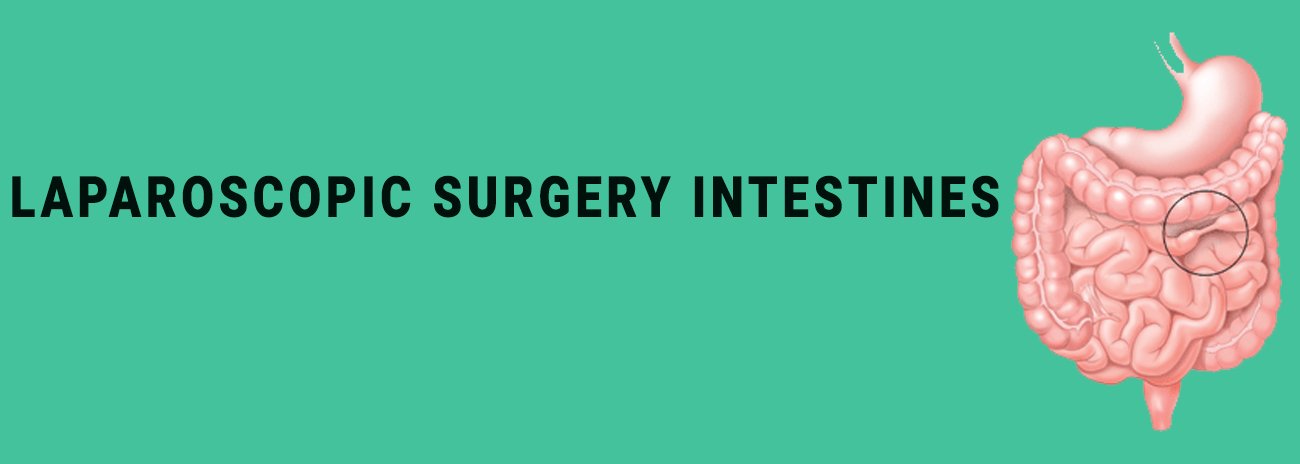 Laparoscopic Surgery of Small and Large Intestines - Dr. Gaurav Mishra ...