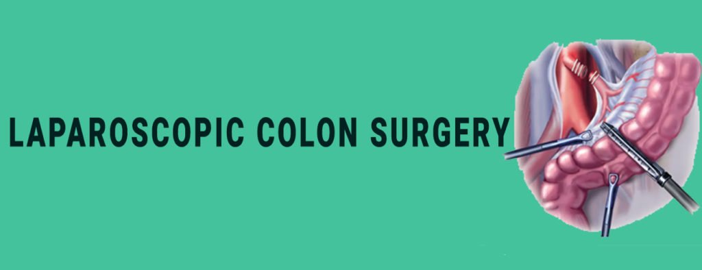 Laparoscopic Colon Surgery - Dr. Gaurav Mishra | General Laparoscopic ...